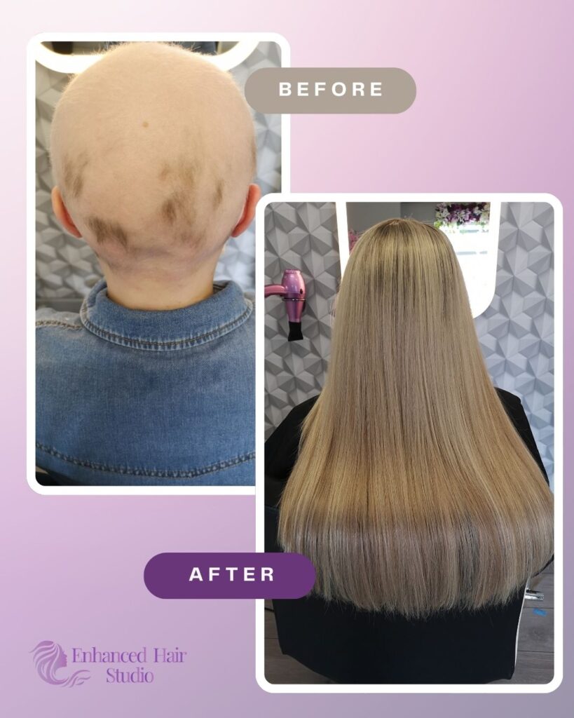 Home - Enhanced Hair Studio | Hair Replacement Solutions Northern ...