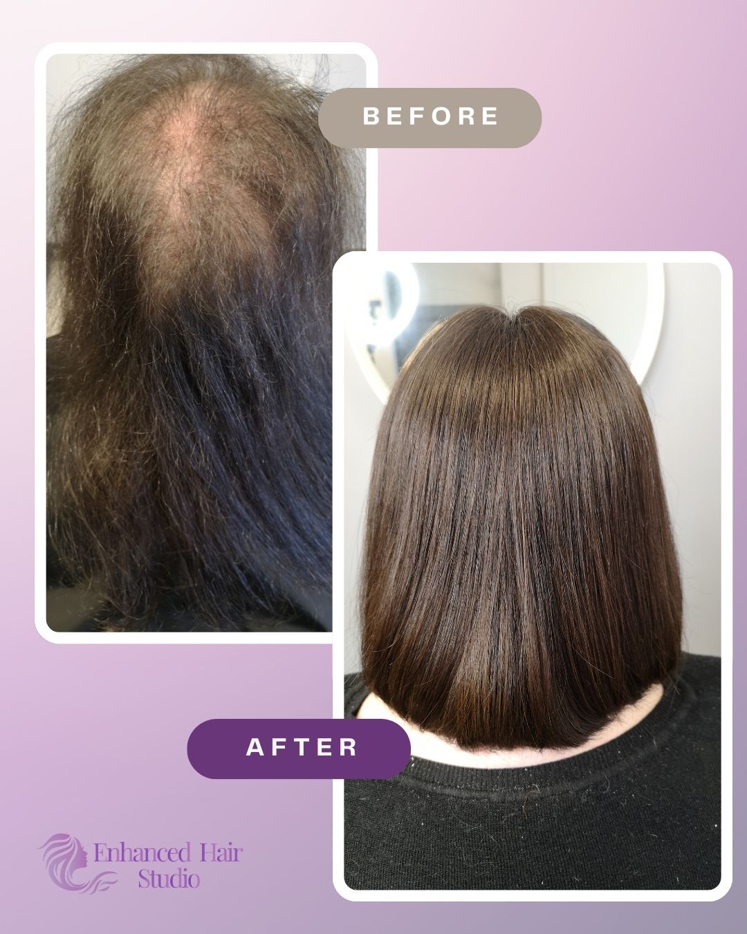 Home - Enhanced Hair Studio | Hair Replacement Solutions Northern ...