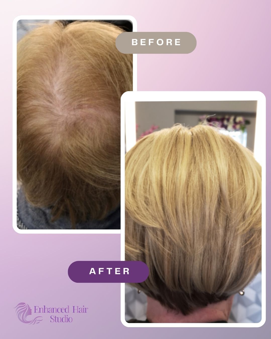Home - Enhanced Hair Studio | Hair Replacement Solutions Northern ...